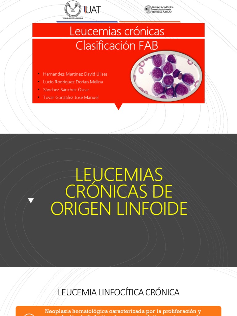 Leucemias crónicas Clasificación FAB | Leucemia | Linfocitos