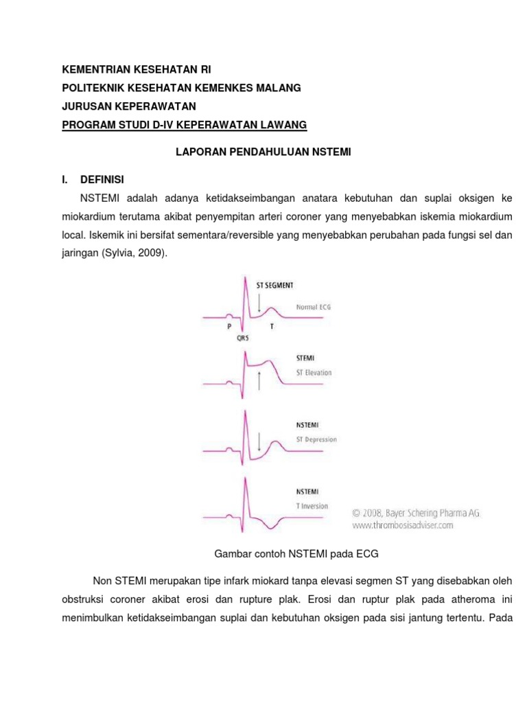 LP Nstemi | PDF