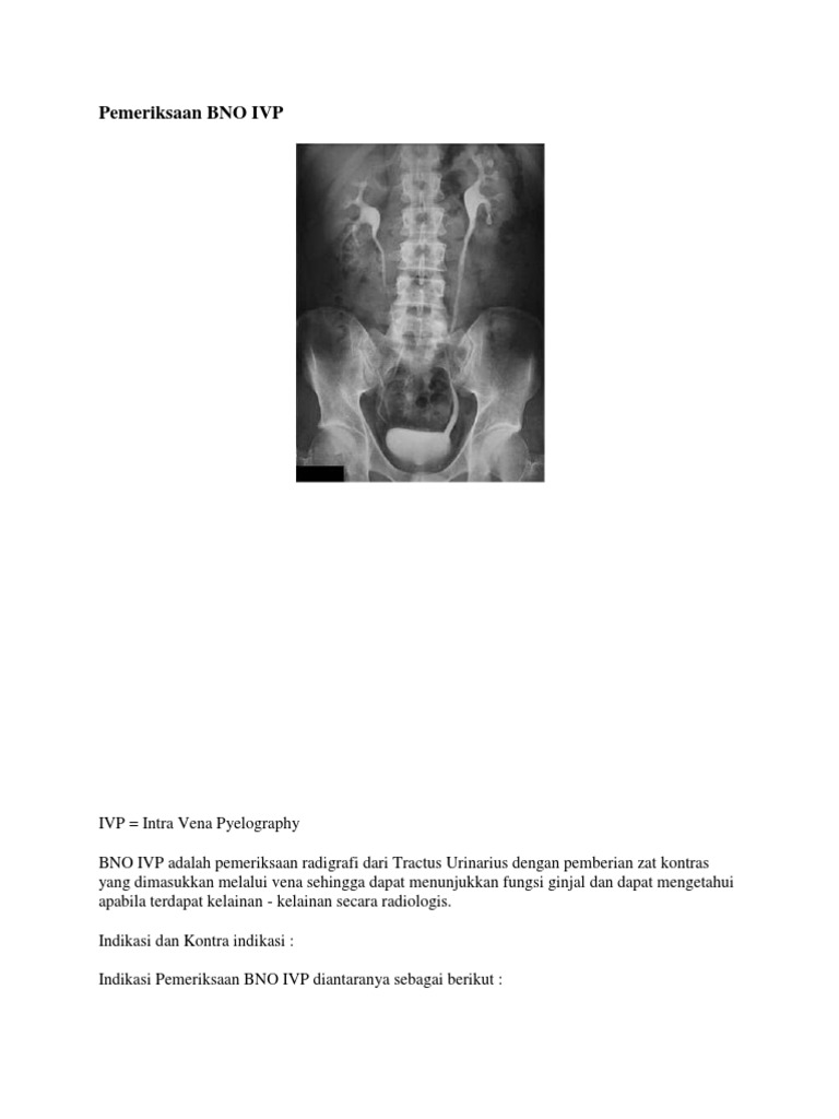 Pemeriksaan BNO IVP | PDF