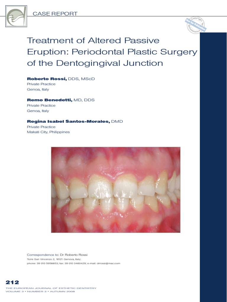 Treatment of Altered Passive Eruption Pe PDF | PDF | Dental Anatomy ...