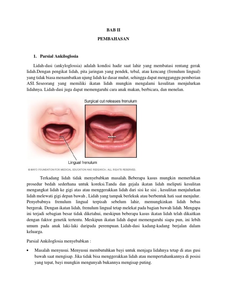 BAB II Kelainan Lidah | PDF