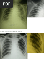 Puqe Index Assessment | PDF