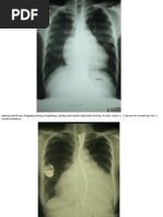 Anatomi Thorax Normal + Gambaran Radiologi | PDF