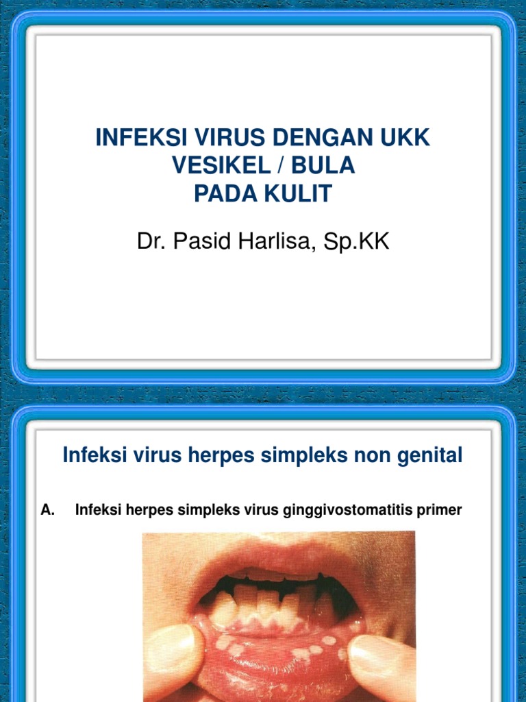 INFEKSI VIRUS DENGAN UKK PADA KULIT | PDF