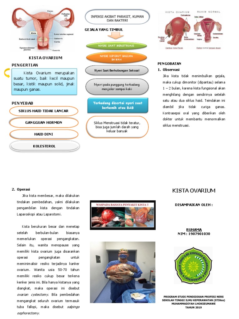 Leaflet Kista Ovarium | PDF