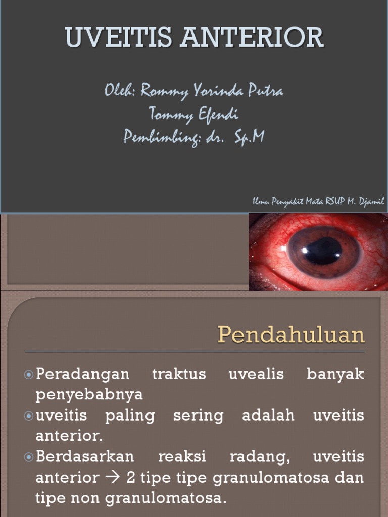 Uveitis Anterior | PDF