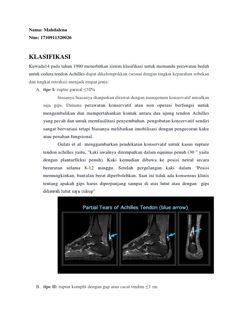 Klasifikasi Ruptur Tendon Achilles | PDF