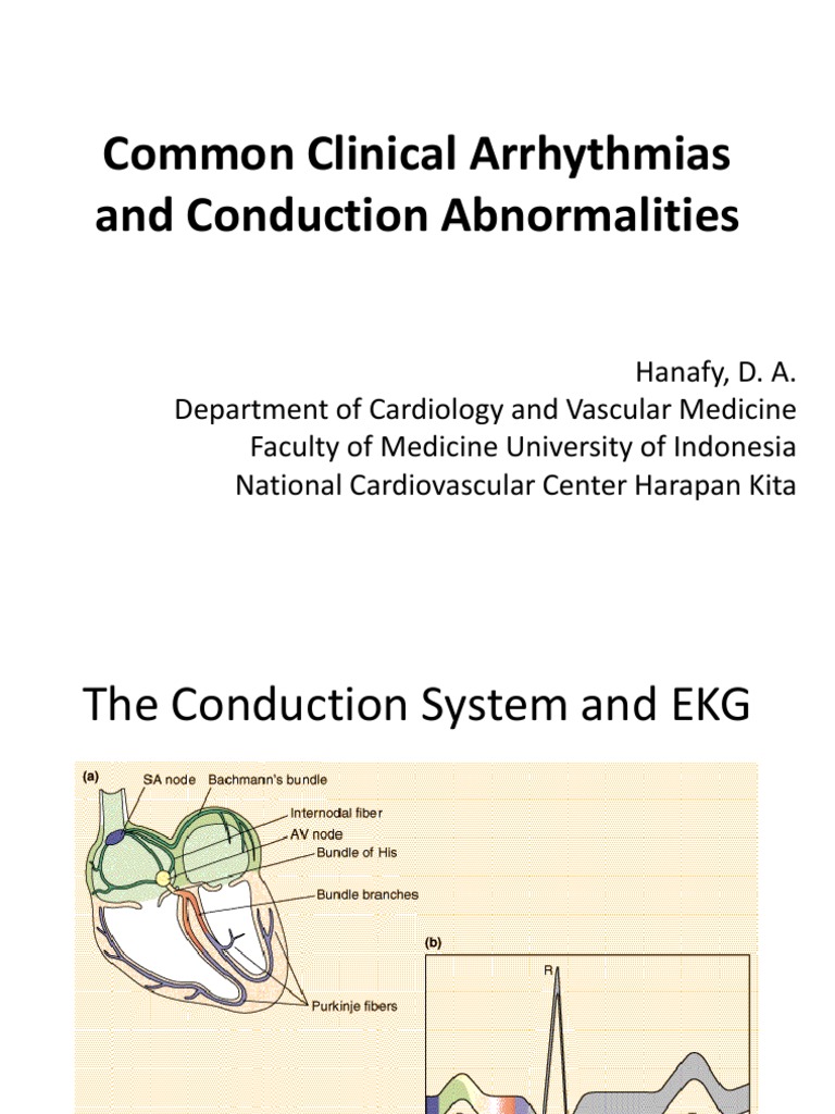 EKG Common Clinical Arrhythmias | PDF | Cardiovascular System ...