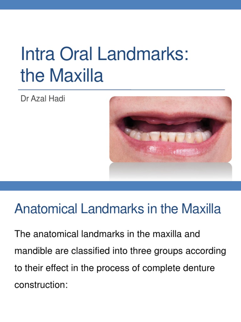 Landmarks of Maxilla | PDF | Lip | Dentures