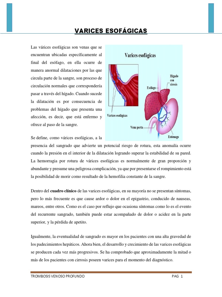 Várices Esofágicas: Causas y Síntomas | PDF | Venas varicosas | Cirrosis