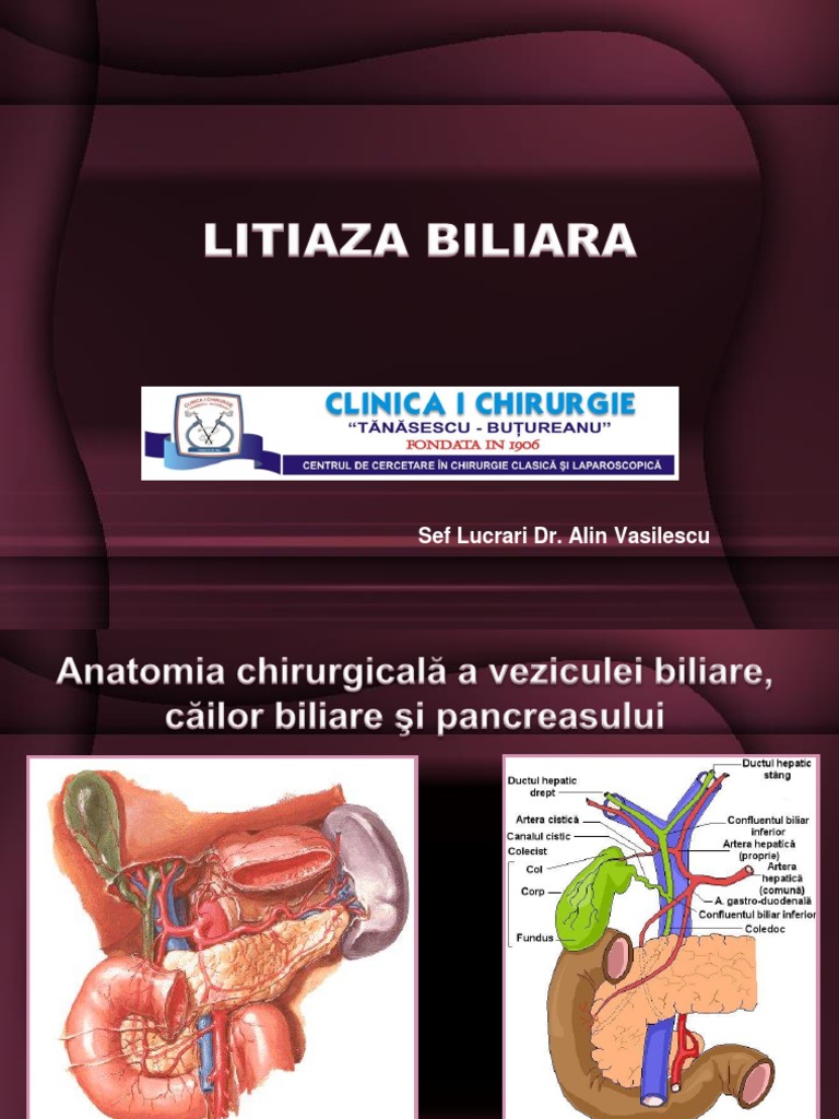 Litiaza | PDF