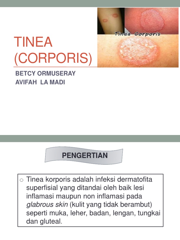 Pengobatan dan Penyebab Tinea Corporis | PDF | Sains & Matematika