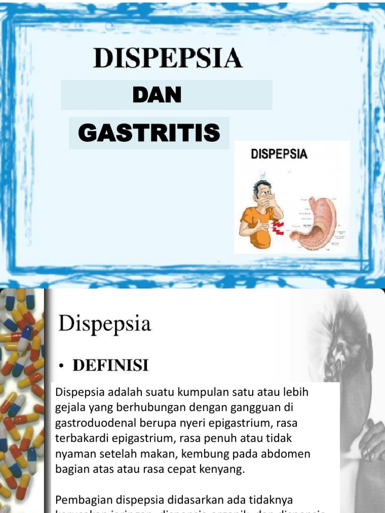 Dispepsia Dan Gastritis | PDF