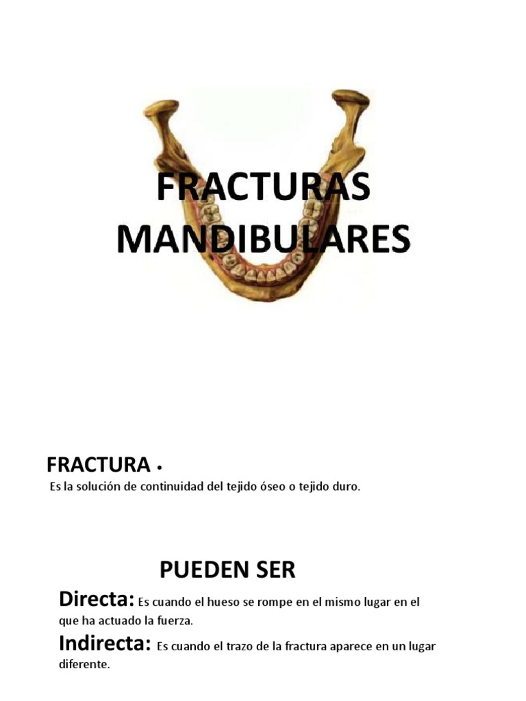 Clasificación De Fracturas Mandibulares: Revisión – KWIVH