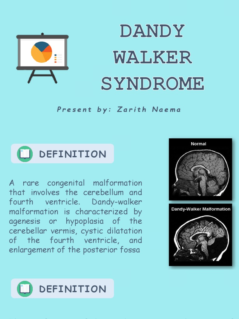 Dandy Walker | PDF | Neurological Disorders | Clinical Medicine
