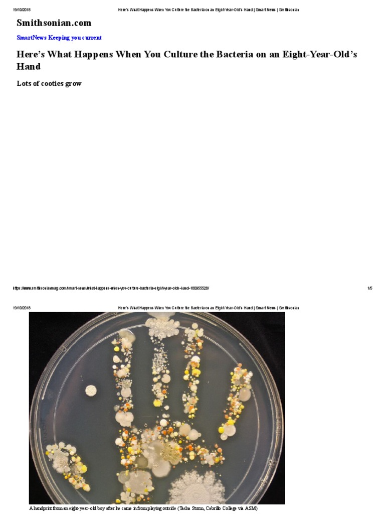 Here's What Happens When You Culture The Bacteria On An Eight-Year-Old ...