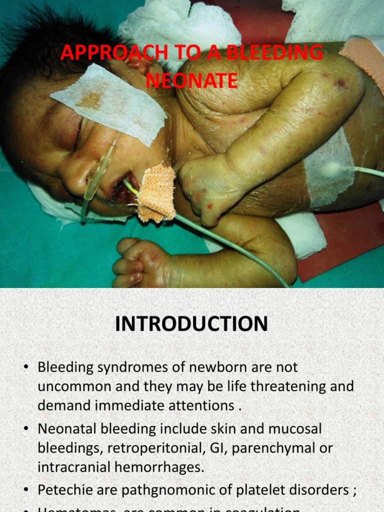 Approach To A Bleeding Neonate | PDF | Coagulation | Platelet