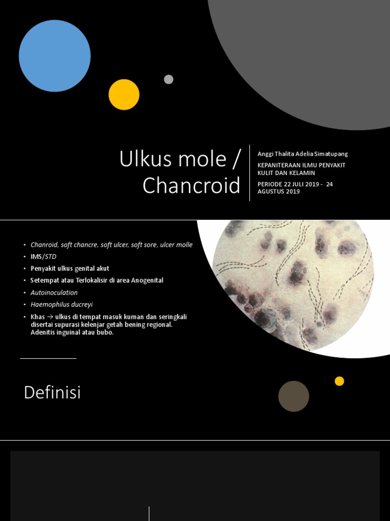 Ulkus Mole | PDF