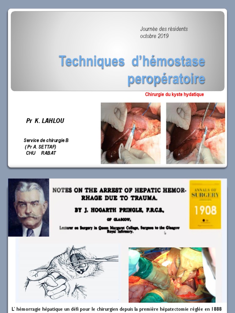 Techniques d'hémostase en chirurgie hépatique | PDF | Saignement | Foie