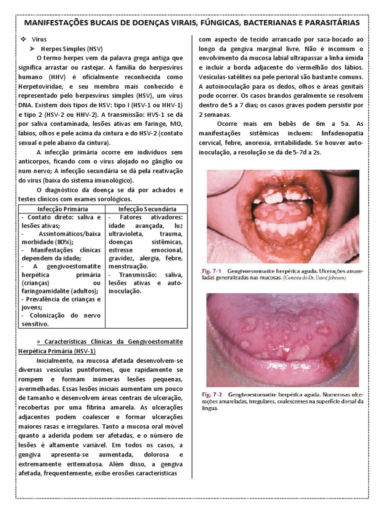 Manifestações Bucais de Doenças Virais | PDF | Herpes simples | HIV/AIDS
