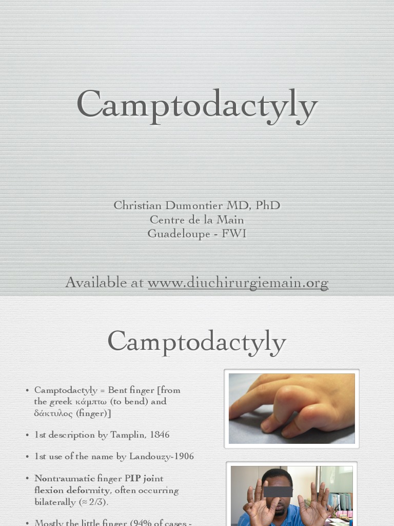 Camptodactyly: Christian Dumontier MD, PHD Centre de La Main Guadeloupe ...