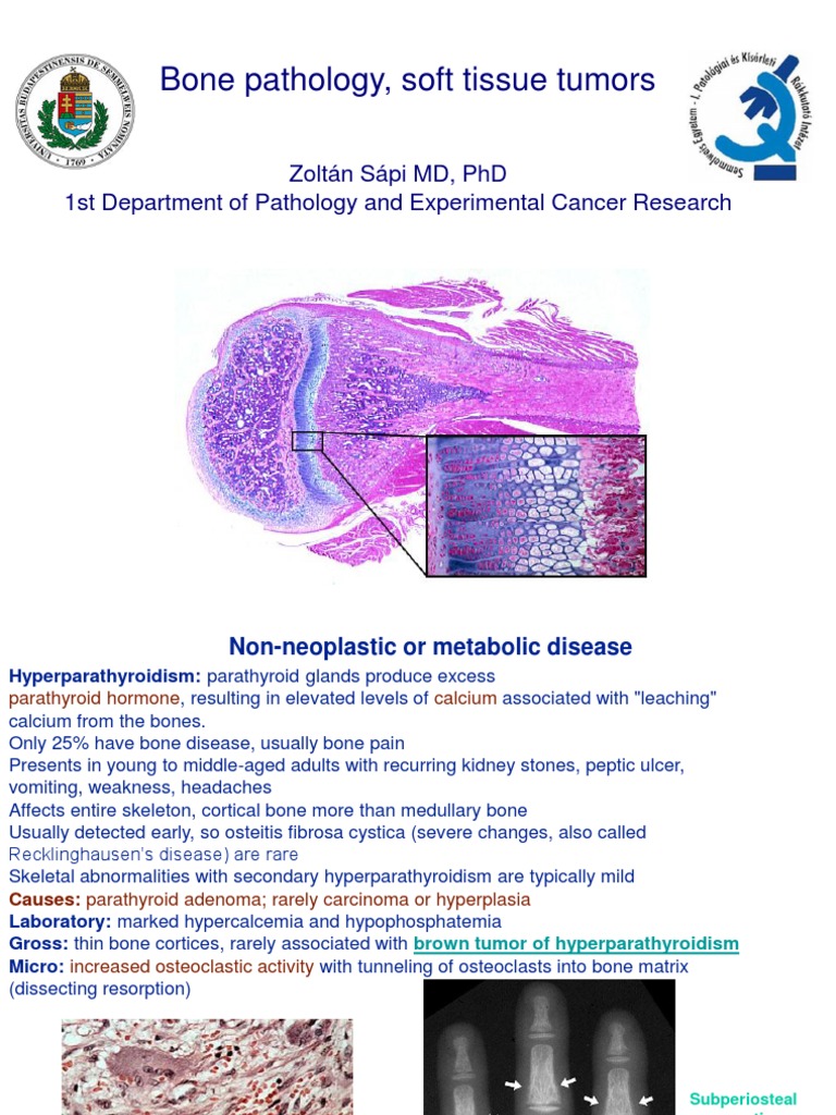Tumor | PDF | Bone | Neoplasms