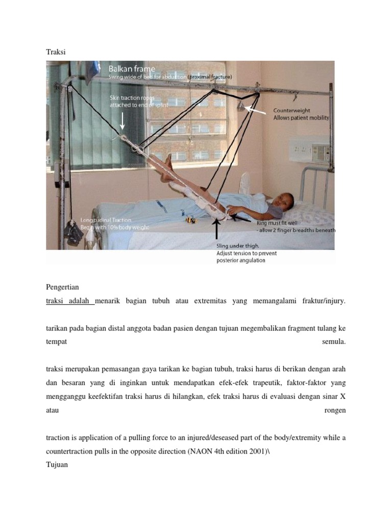 Traksi | PDF
