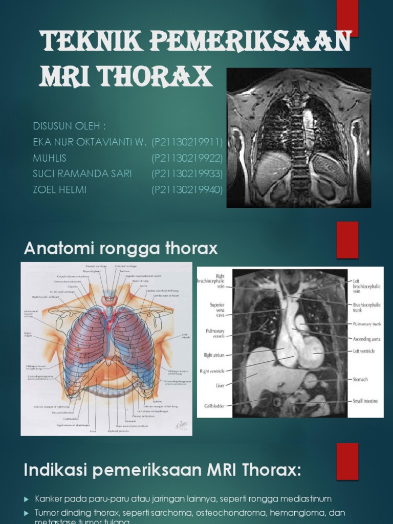 MRI Thorax | PDF