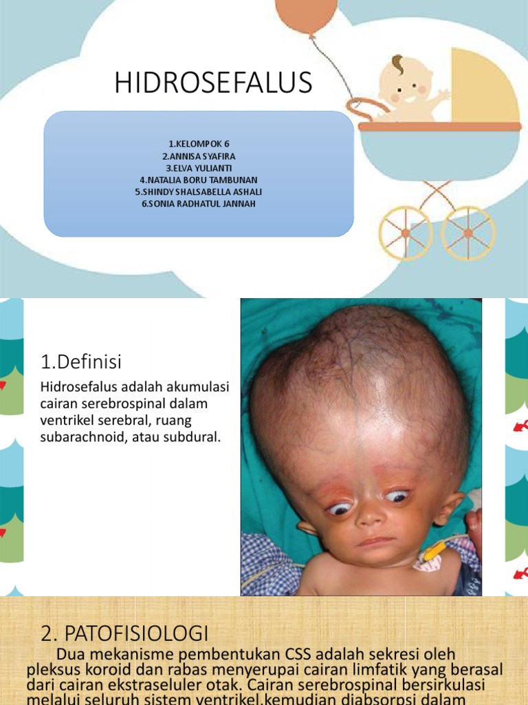 Hidrosefalus Perbaikan | PDF | Kesehatan Holistik