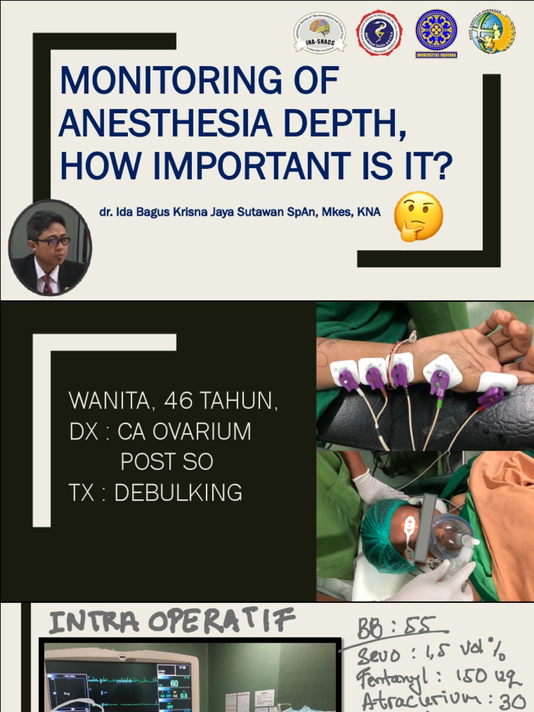 Monitoring Anesthesia Dept | PDF