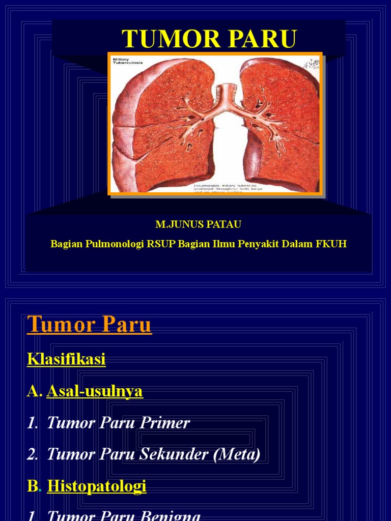 Tumor Paru Revisi | PDF