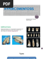 Localized Multiple Cemental Excrescences Hipercementosis | PDF ...