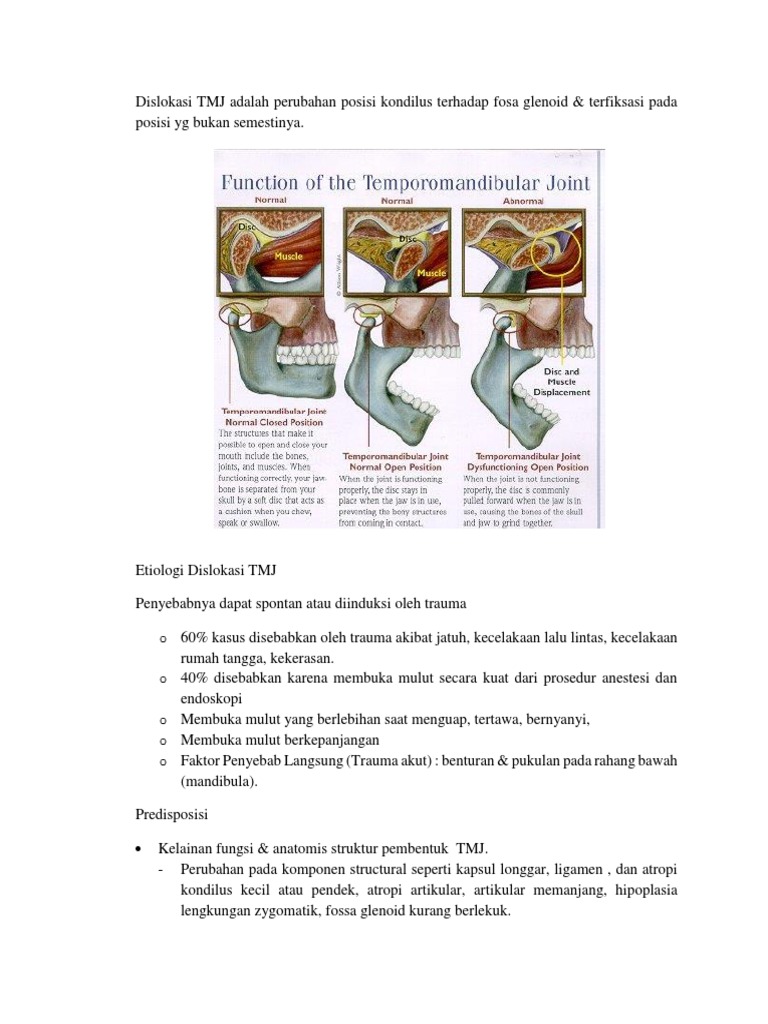 Dislokasi TMJ: Penyebab dan Mekanisme | PDF