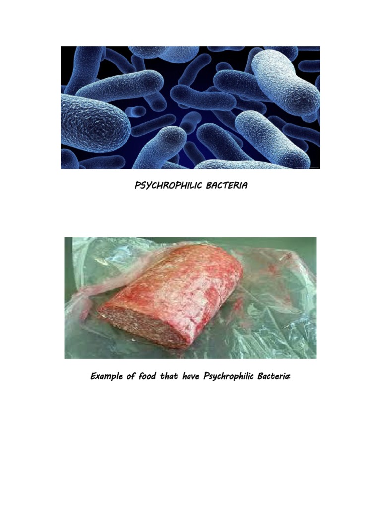 Bacteria Types in Foods | PDF