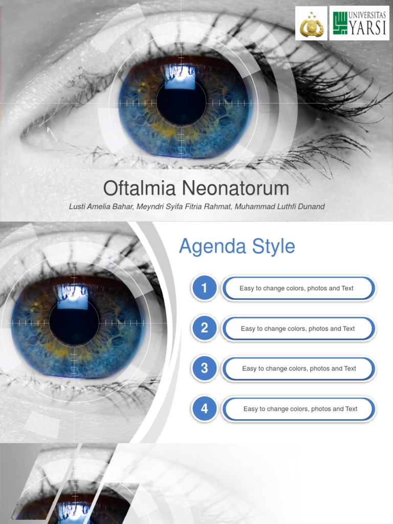 Eye Scanning Ophthalmology PowerPoint Template | PDF | Microsoft Power ...