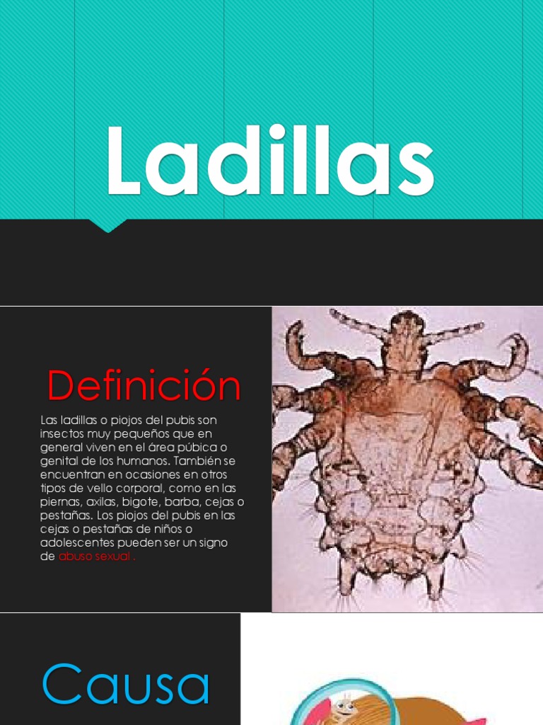 Ladillas | PDF