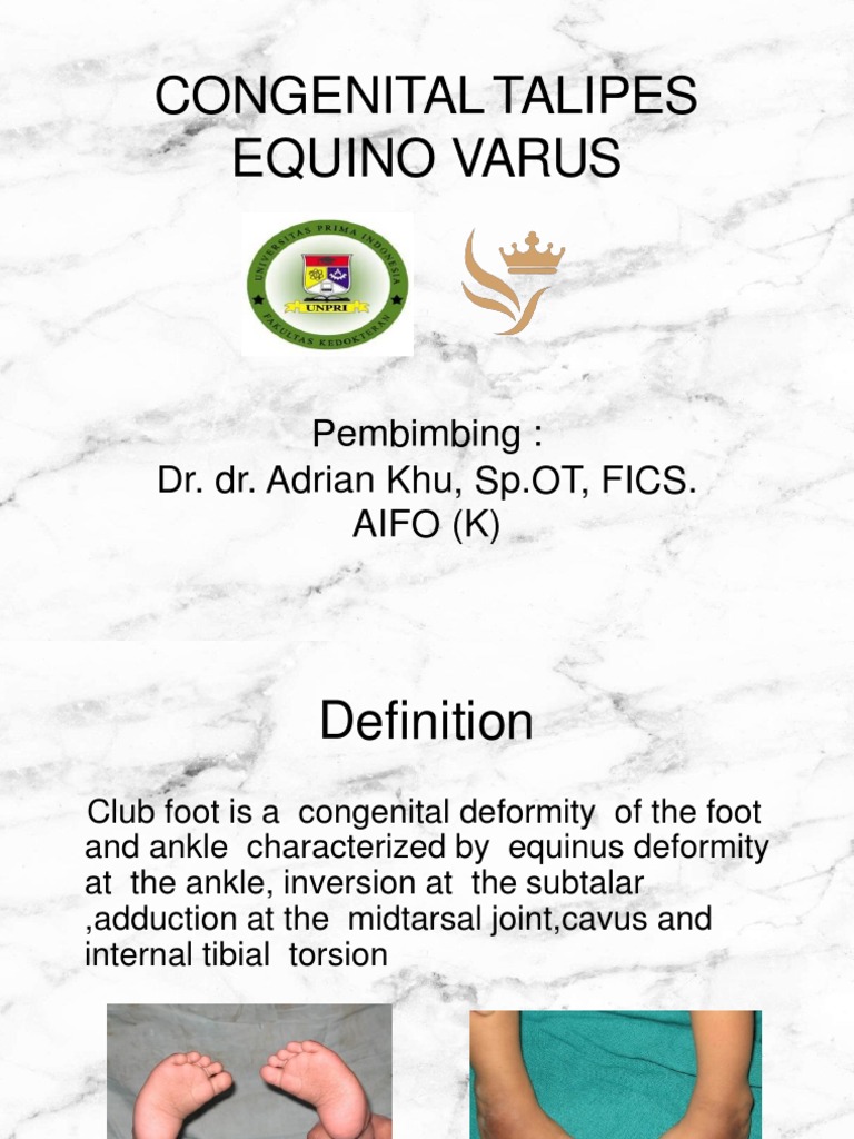 Congenital Talipes Equino Varus (Clubfoot | PDF | Congenital Disorder ...