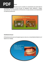 Linea de Fulcrum | PDF