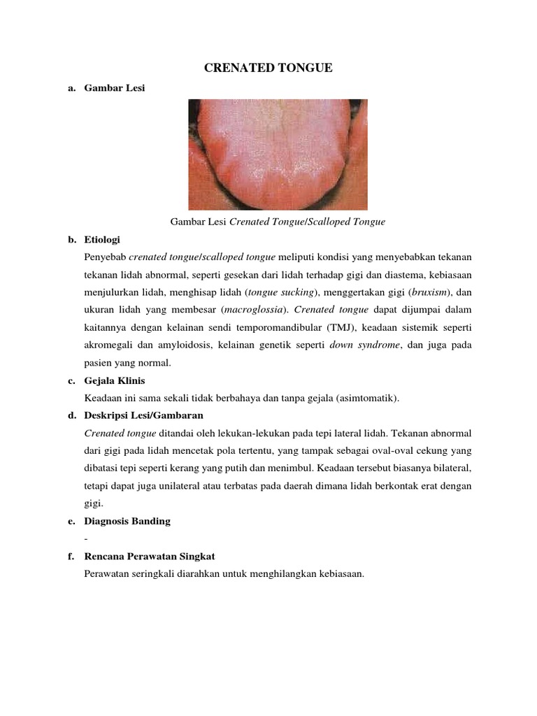 Crenated Tongue | PDF