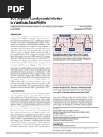 ACLS Exam Version A | PDF | Cardiopulmonary Resuscitation | Cardiac Arrest