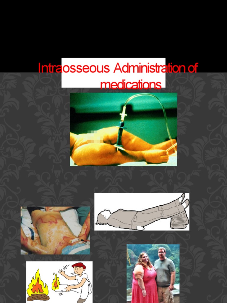 Intraosseous Administration of Medications | PDF | Medical Specialties ...