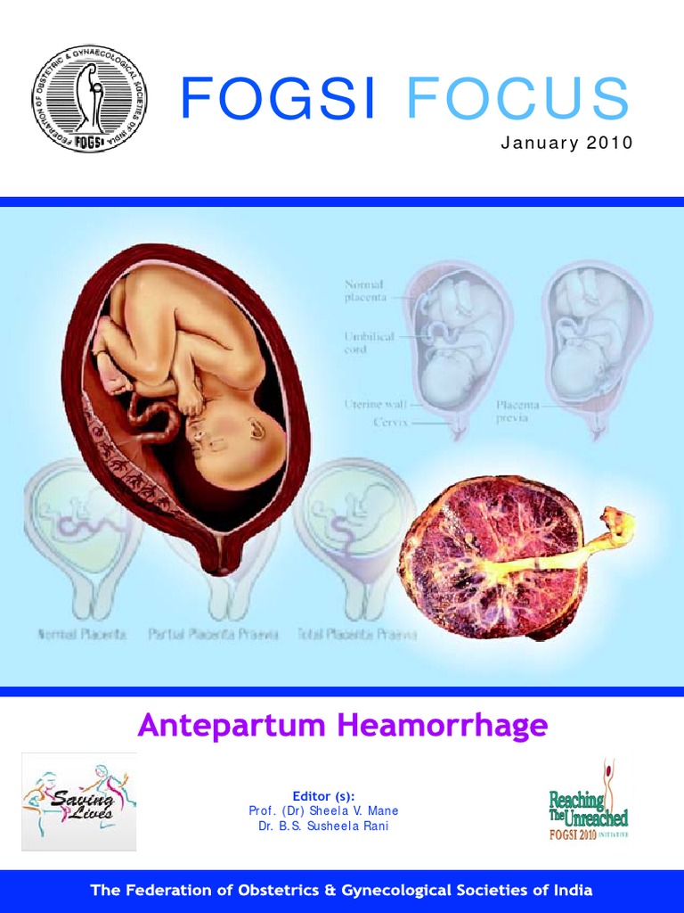 Antepartum Hemorrhage Management Guide | PDF | Maternal Death | Childbirth