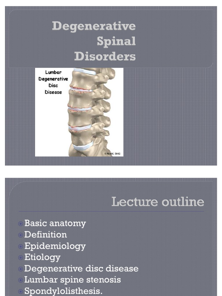 Degenerative Spinal Disorders | Vertebral Column | Musculoskeletal System