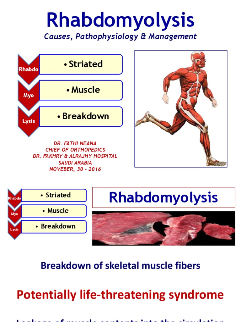 Rhabdomyolysis: - Striated - Muscle - Breakdown | Download Free PDF ...