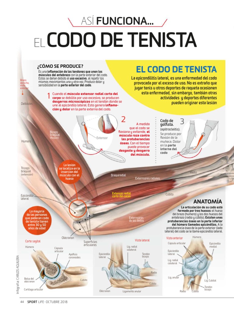 Codo de Tenista | PDF | Codo | Extremidades (anatomía)