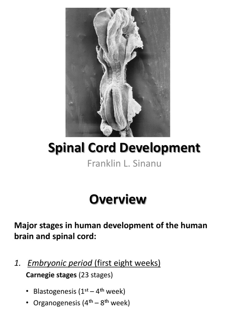 Spinal Cord Development: Franklin L. Sinanu | PDF | Motor Neuron ...