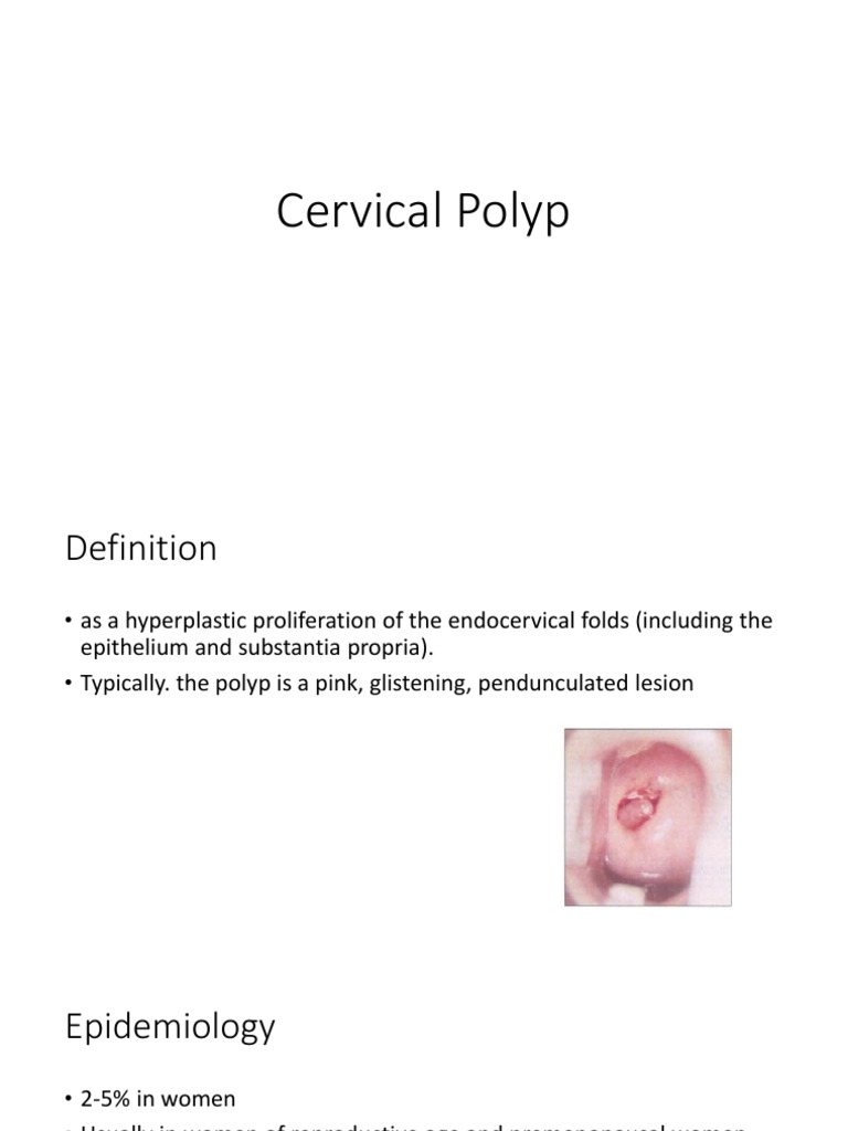 Cervical Polyp | PDF | Self-Improvement | Wellness