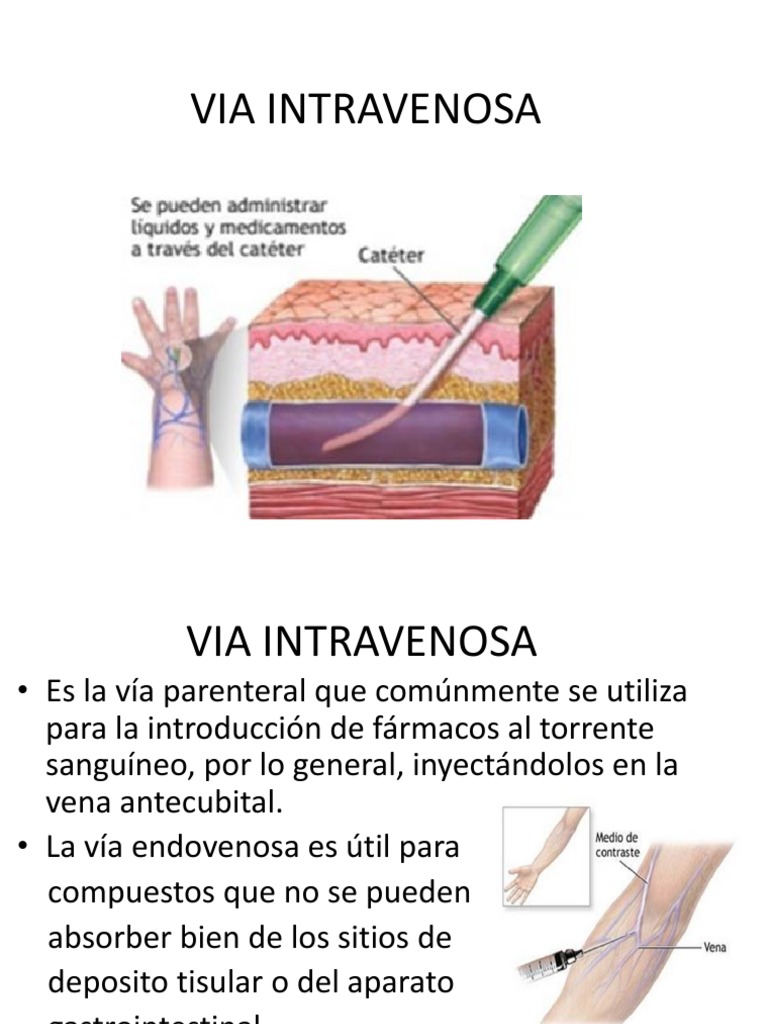Endovenosa Via | PDF | Terapia intravenosa | Tratamientos médicos