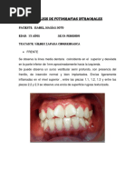 Analisis Facial Pdf Ortodoncia Odontología