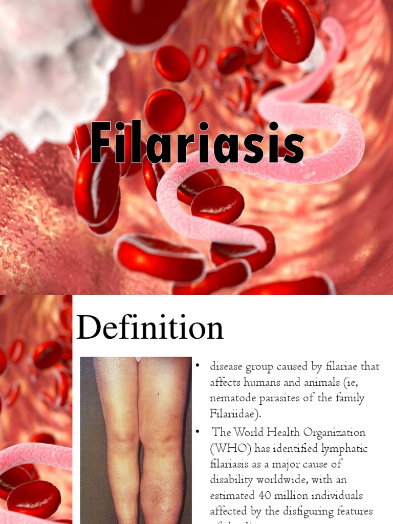 Filariasis | PDF | Immunology | Microbiology